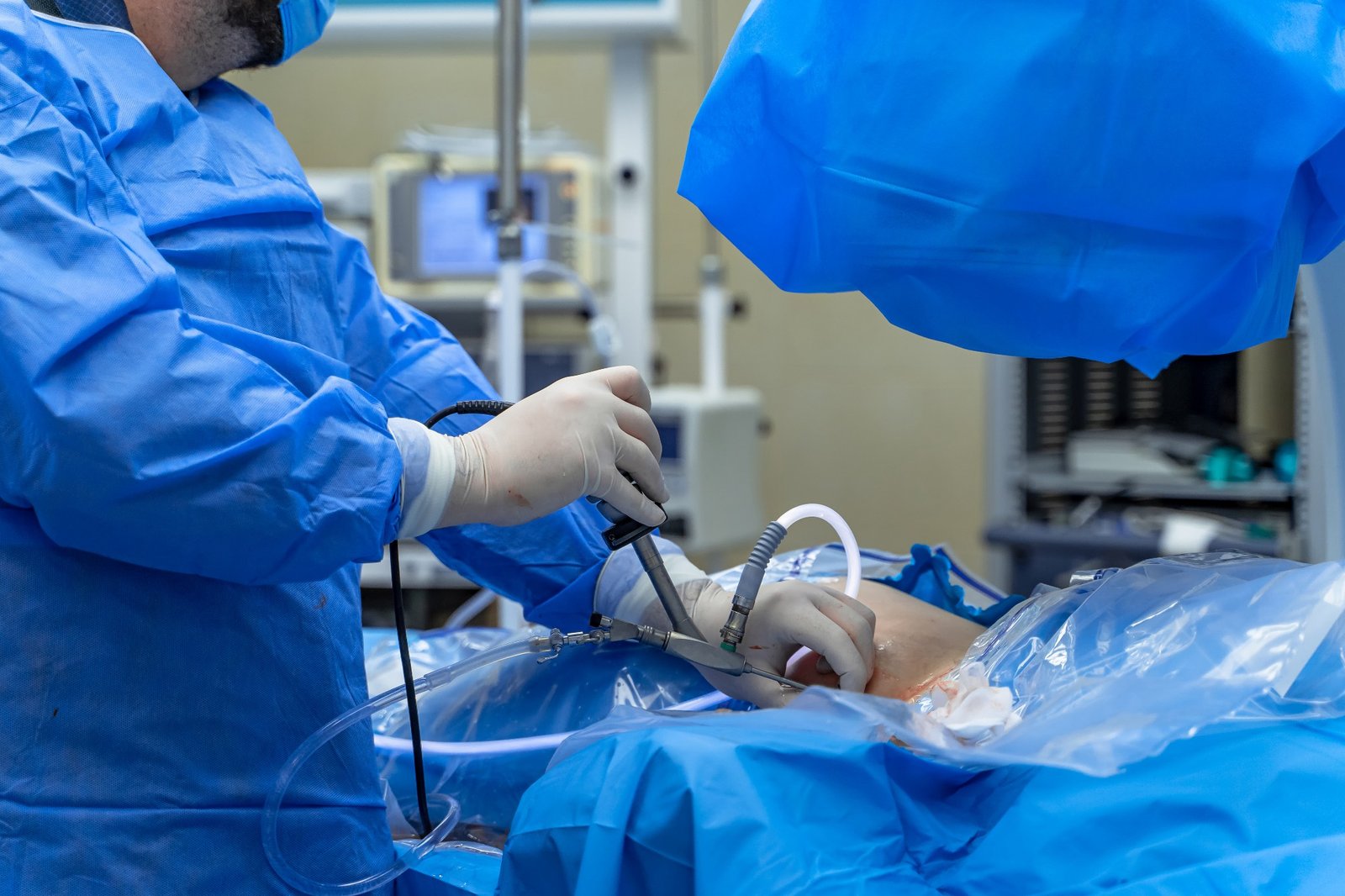 Endoscopic Procedures - drbhavanasingla.com